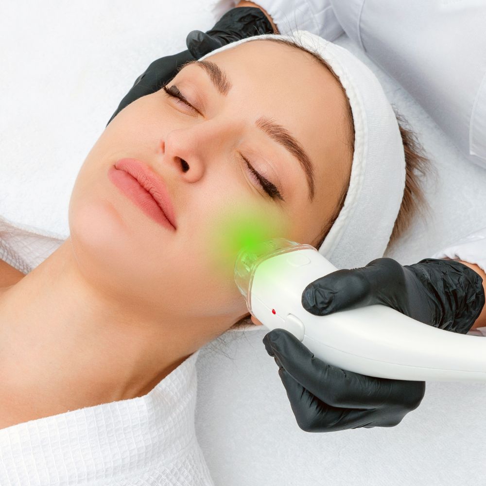 Laser Genesis® Full Face Laser Treatment – Richmond Skin & Laser Clinic